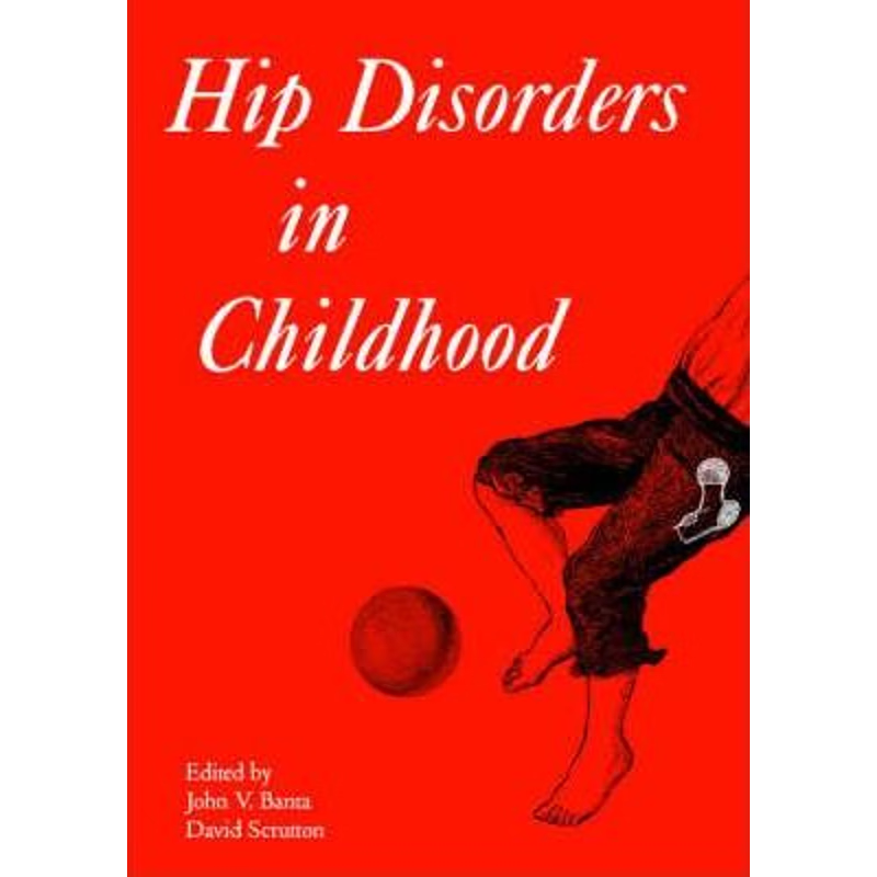 按需印刷Hip Disorders in Childhood[9781898683339]
