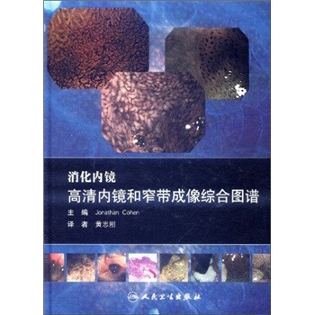 消化内镜高清内镜和窄带成像综合图谱（附光盘）