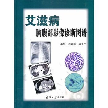 艾滋病胸腹部影像诊断图谱9787302233275