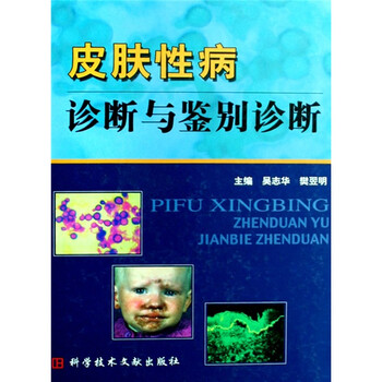 皮肤性病诊断与鉴别诊断