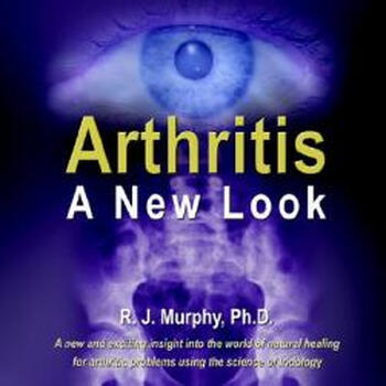 【】Arthritis-A New Look: Arth