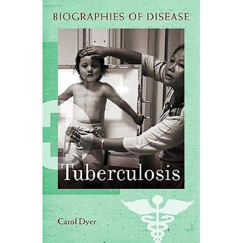 Tuberculosis