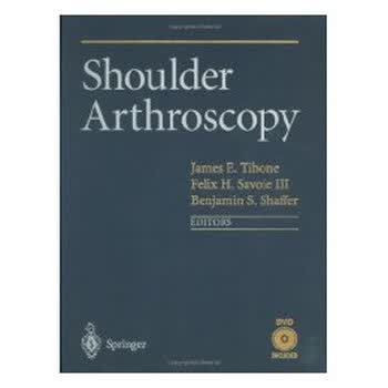 【】Shoulder Arthroscopy