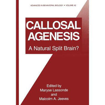 Callosal Agenesis : A Natural Split Brain?