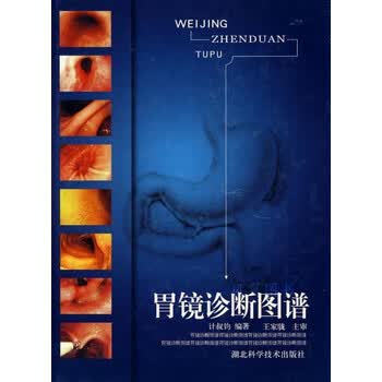 胃镜诊断图谱 计叔钧编著 湖北科学技术出版社
