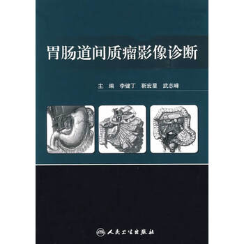 胃肠道间质瘤影像诊断