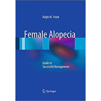 Female Alopecia: Guide to Successful Management 
