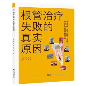 根管治疗失败的真实原因 口腔医学书籍牙髓病治疗书籍 根管清理冲洗液及冲洗方法
