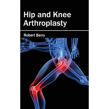 Hip and Knee Arthroplasty