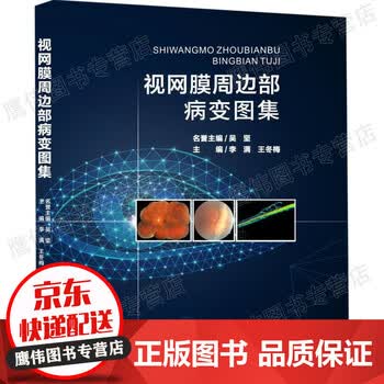视网膜周边部病变图集(精)