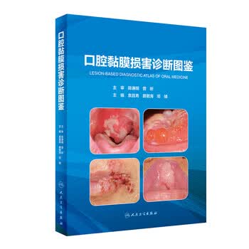 [正版图书]口腔黏膜损害诊断图鉴