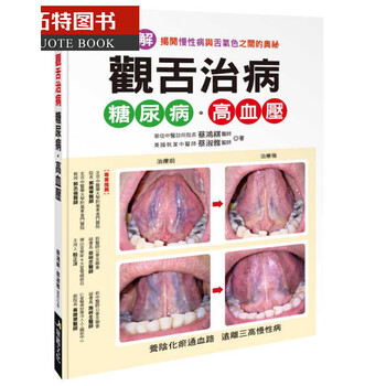 预售 蔡鸿祺观舌治病 糖尿病．高血压揭开慢性病与舌气色之间的奥秘康鉴文化