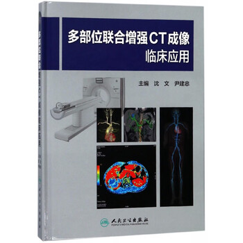 多部位联合增强CT成像临床应用(精)