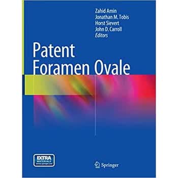 高被引Patent Foramen Ovale