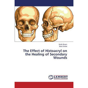The Effect of Histoacryl on the Healing of Secon
