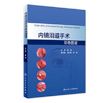 内镜泪道手术彩色图谱