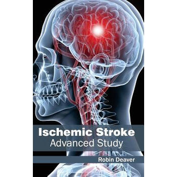 Ischemic Stroke: Advanced Study