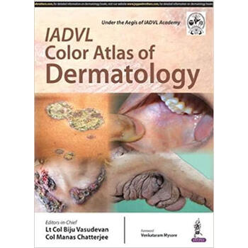 IADVL Color Atlas of Dermatology