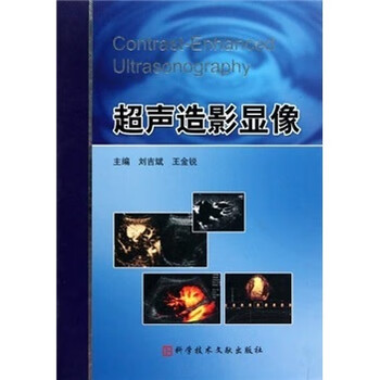 超声造影显像 刘吉斌,王金锐 著【正版书】