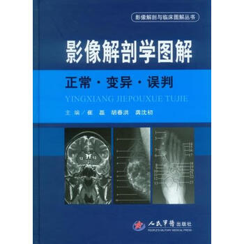 影响解剖学图解-正常-变异-误判