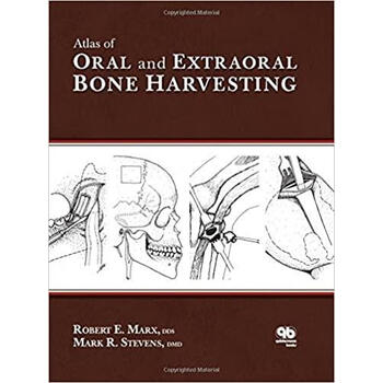 Atlas of Oral and Extraoral Bone Harvesting     