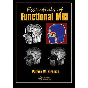Essentials of Functional MRI