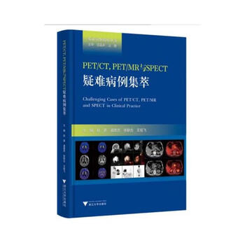 PET/CT,PET/MR与SPECT疑难病例集萃