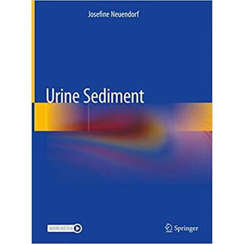 Urine Sediment