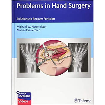 Problems in Hand Surgery: Solutions to Recover F