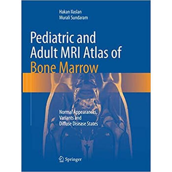Pediatric and Adult MRI Atlas of Bone Marrow: No