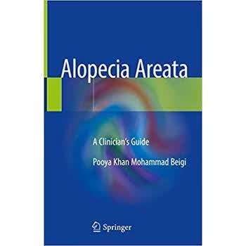 Alopecia Areata: A Clinician's Guide