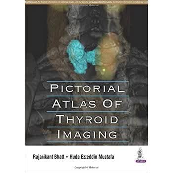 Pictorial Atlas of Thyroid Imaging