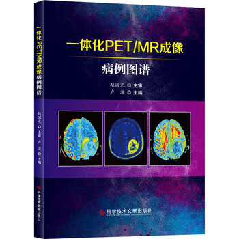 一体化PET/MR成像病例图谱