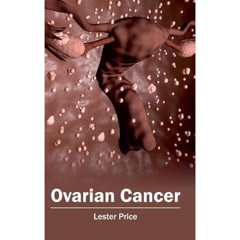 Ovarian Cancer