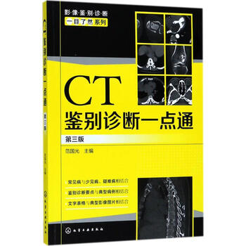 CT鉴别诊断一点通 范国光 化学工业出版社