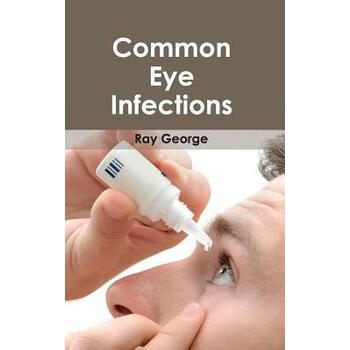 Common Eye Infections