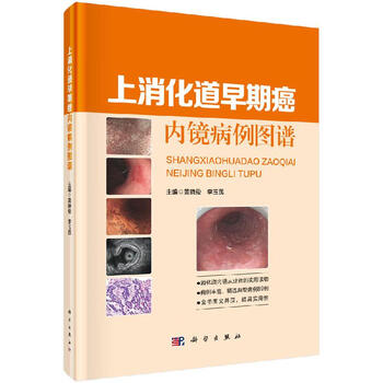 上消化道早期癌内镜病例图谱/科学出版社