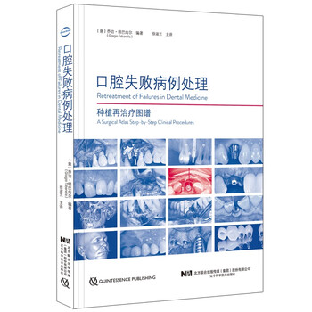口腔失败病例处理