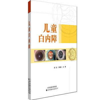 白内障医学小儿疾病白内障诊疗青年图书