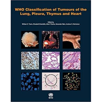 Who Classification of Tumours of the Lung, P...