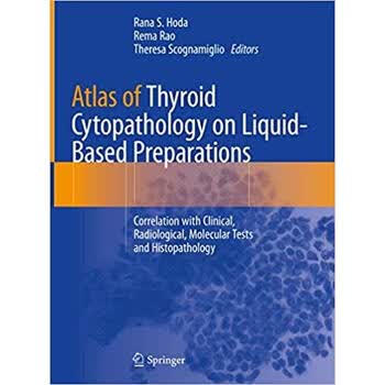 Atlas of Thyroid Cytopathology on Liquid-Based P
