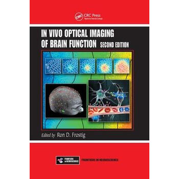 In Vivo Optical Imaging of Brain Function