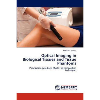 Optical Imaging in Biological Tissues and Tissue