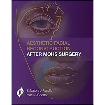 Aesthetic Facial Reconstruction After Mohs Surge