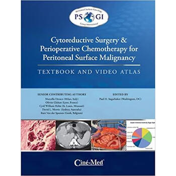 Cytoreductive Surgery and Perioperative Chemothe