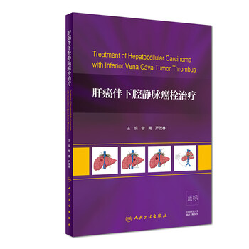 肝癌伴下腔静脉癌栓治疗(精)