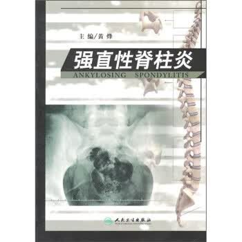 强直性脊柱炎 黄烽 编