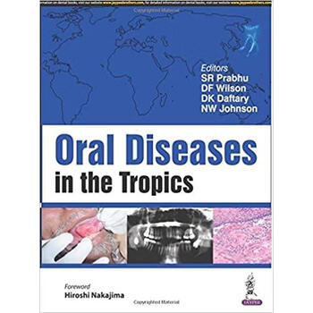 Oral Diseases in the Tropics                    