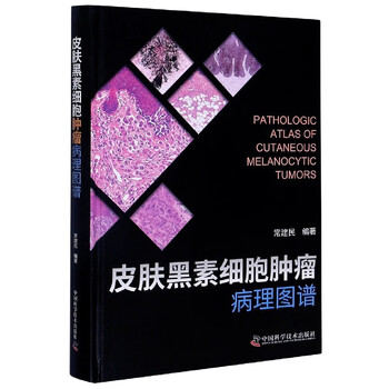 皮肤黑素细胞肿瘤病理图谱(精)