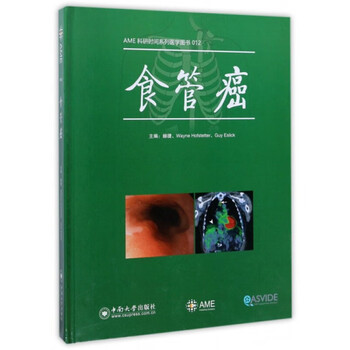 食管癌 医学 肿瘤学书籍 中南大学出版社